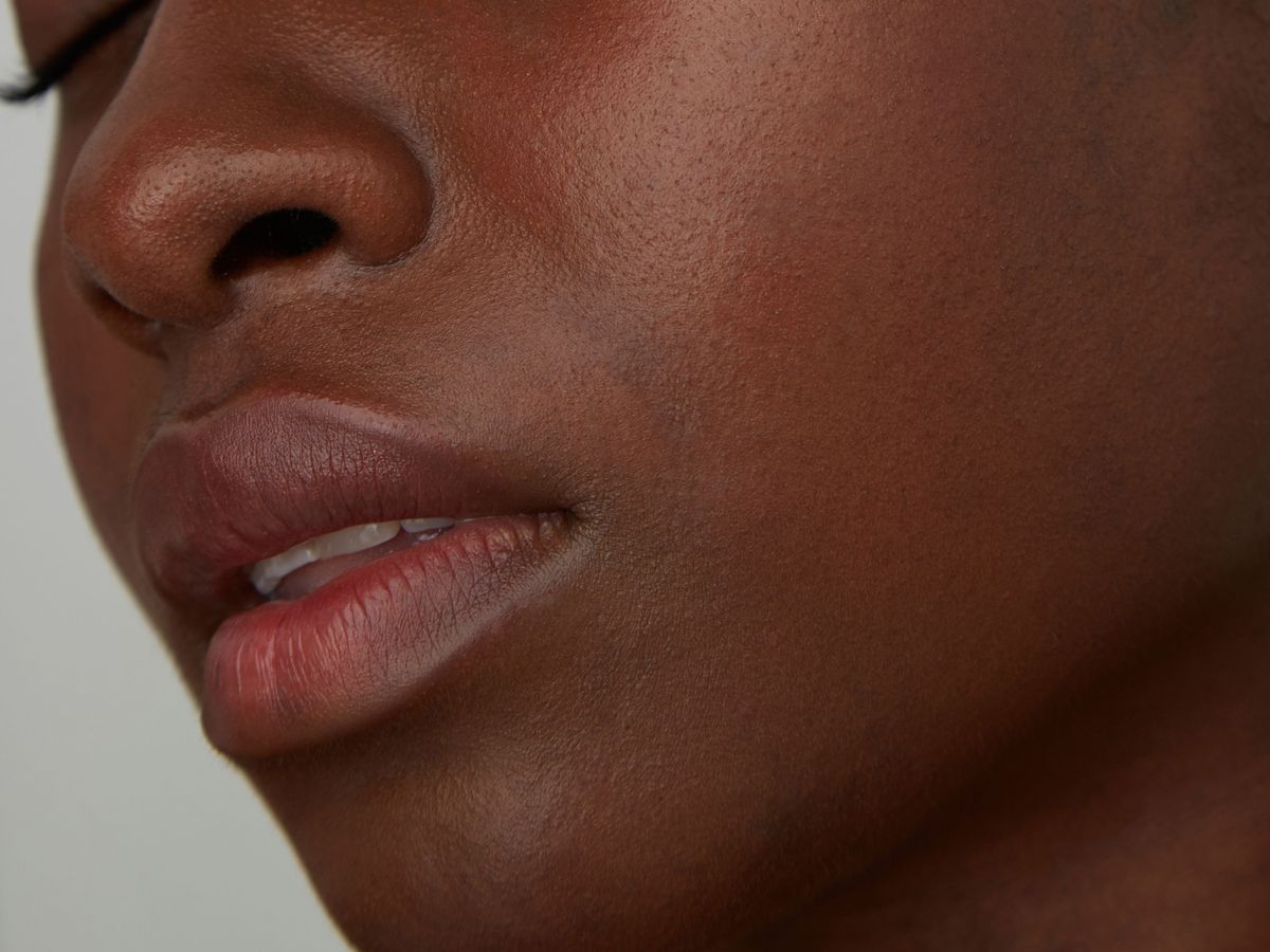 This is what stress is doing to your skin - Vogue Scandinavia